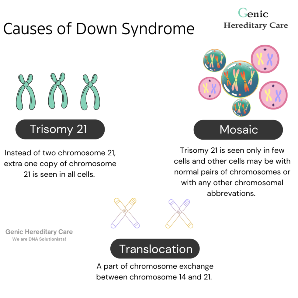 Down syndrome- From unknown to known - Genic Hereditary Care